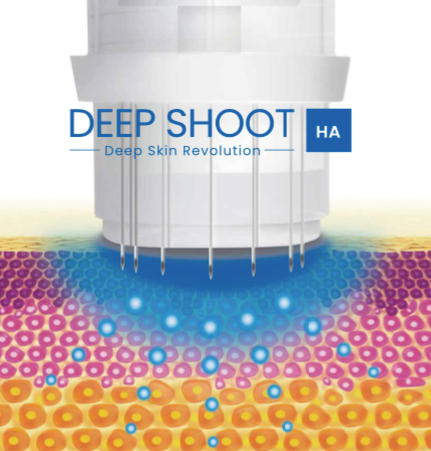 Ribeskin Combo DEEP SHOOT HA + MASK for Deep Hydration – Unlimited ...